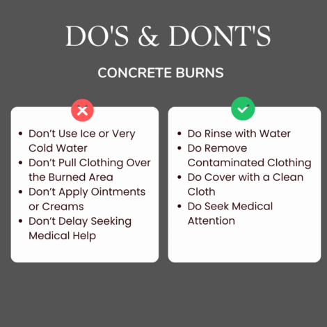 How to Treat Cement and Concrete Burns Safely
